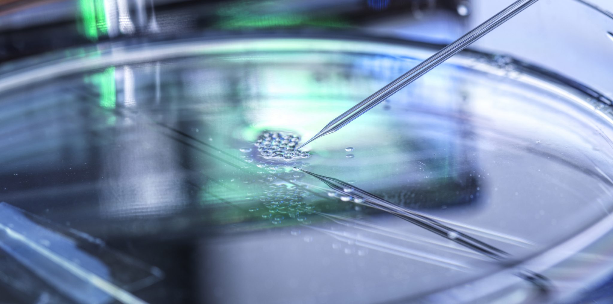 Associate Professor Levi Waldron awarded cancer genomics grant ...